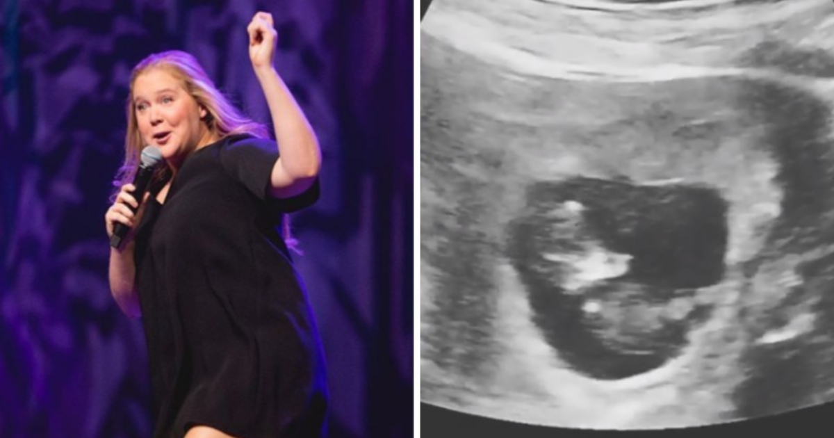 Expectant Amy Schumer reveals her unborn baby to the world